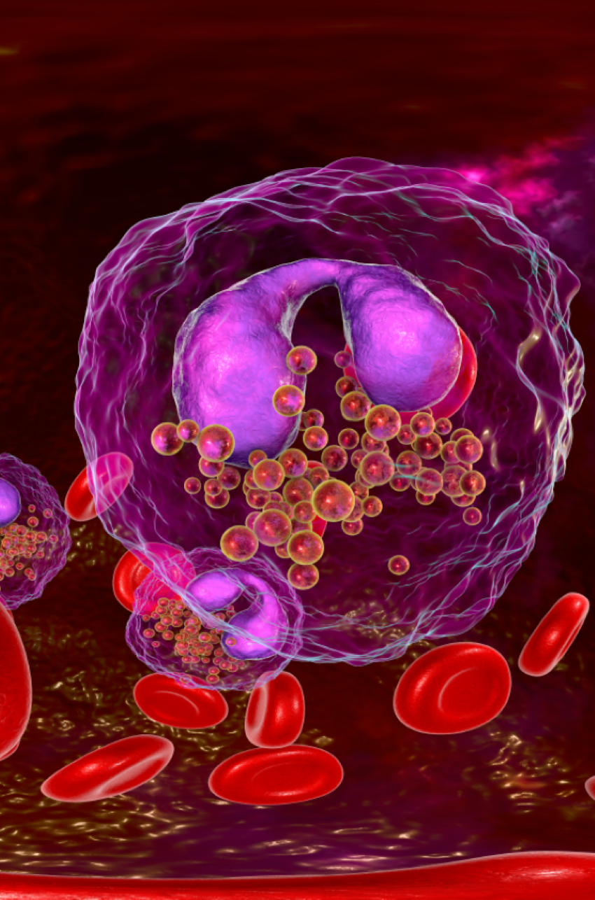 Conversations in CLL: How will the Data Presented at ASCO Impact ...